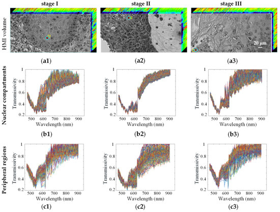 Staging of Skin Cancer Based on Hyperspectral Microscopic Imaging and ...