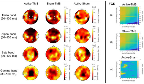 Investigation of Spatiotemporal Profiles of Single-Pulse TMS-Evoked ...