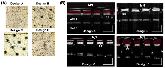 Direct Capture and Early Detection of Lyme Disease Spirochete in Skin ...