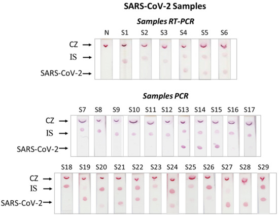 A Molecular Lateral Flow Assay for SARS-CoV-2 Quantitative Detection