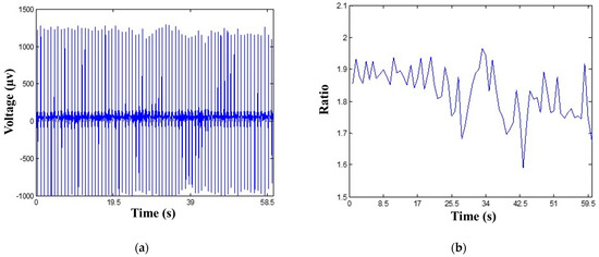 Vital Signs Sensing Gown Employing ECG-Based Intelligent Algorithms