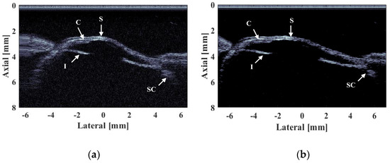 A High-Frequency Mechanical Scanning Ultrasound Imaging System