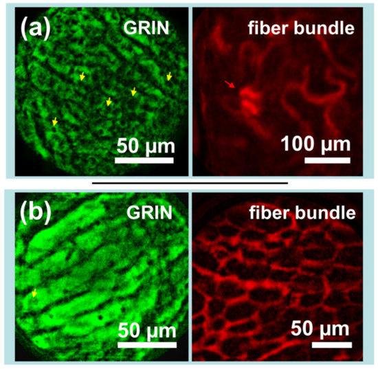 Spectral Multiplexing of Fluorescent Endoscopy for Simultaneous Imaging ...