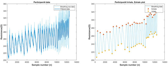 Biosensors | Free Full-Text | Textile Knitted Stretch Sensors for ...