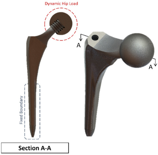 Surface Acoustic Wave (SAW) Sensors for Hip Implant: A Numerical and ...