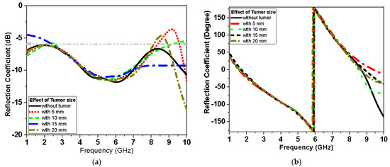 Complete Breast Cancer Detection and Monitoring System by Using ...