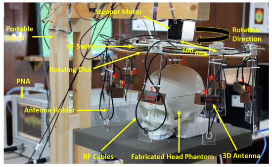 Brain Tumor Segmentation And Classification From Sensor Based Portable Microwave Brain Imaging