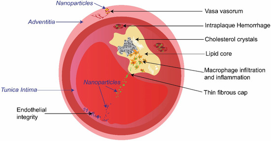 Intravascular Imaging of Atherosclerosis by Using Engineered Nanoparticles