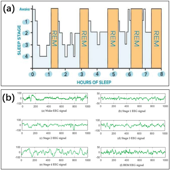 Biosensors | Free Full-Text | Recent Progress in Long-Term Sleep ...