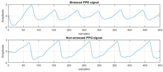 Mental Stress Detection Using a Wearable In-Ear Plethysmography
