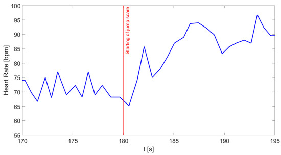 Wearable Multisensor Ring-Shaped Probe for Assessing Stress and Blood ...