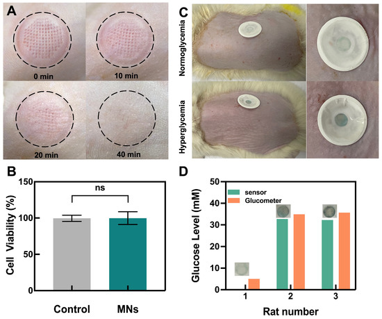 Porous Colorimetric Microneedles for Minimally Invasive Rapid Glucose ...