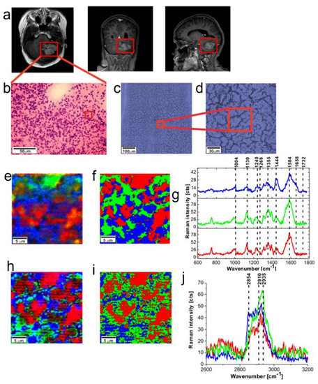 Molecular Fingerprint Detection Using Raman and Infrared Spectroscopy ...