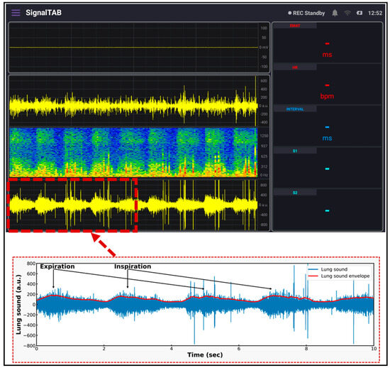 Biosensors | Free Full-Text | Tablet-Based Wearable Patch Sensor Design ...