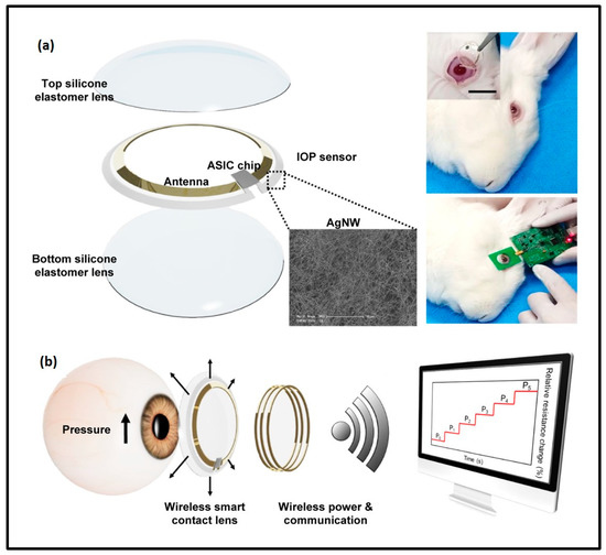 Current Innovations in Intraocular Pressure Monitoring Biosensors for ...