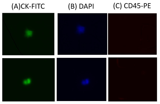 Gold Nanoparticle-Based Microfluidic Chips for Capture and Detection of ...