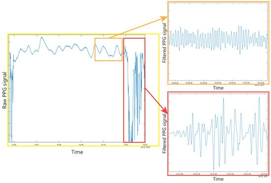 An ML-Based Approach to Reconstruct Heart Rate from PPG in Presence of ...