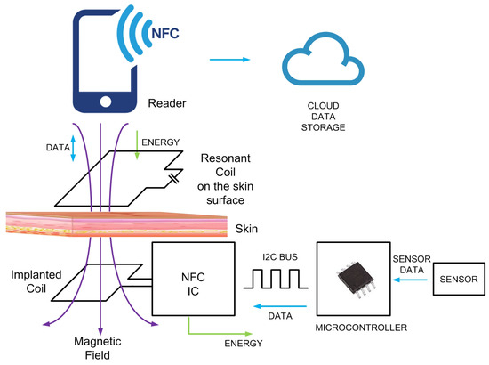 Biosensors | Free Full-Text | Recent Advances in Batteryless NFC ...