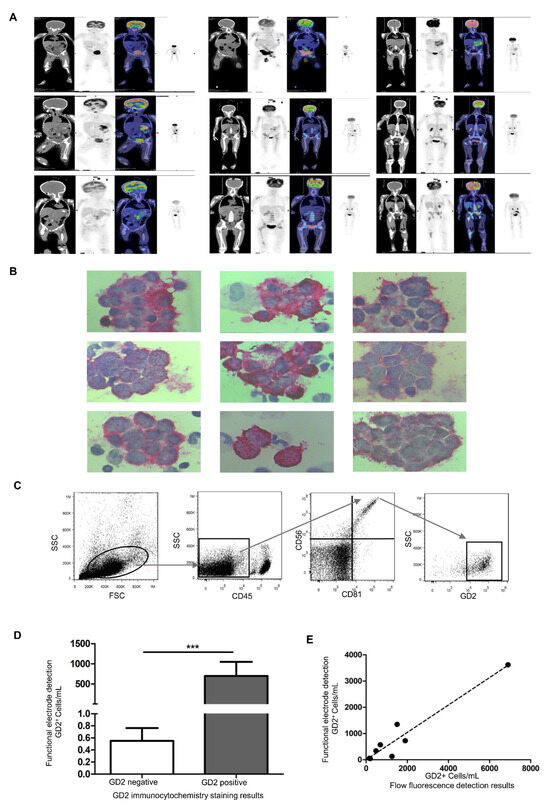 Functionalized GD2 Electrochemical Immunosensor to Diagnose Minimum ...