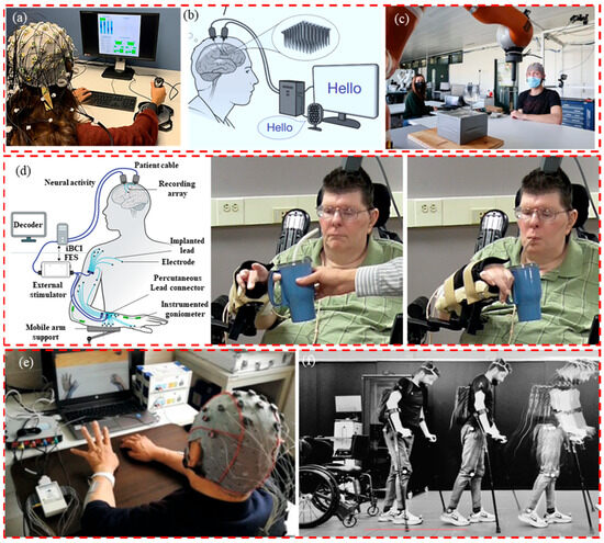 Biosensors | Free Full-Text | Application and Development of EEG ...
