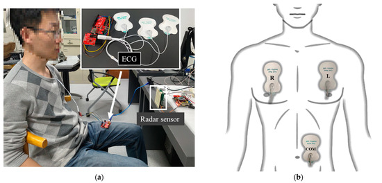Noncontact Cardiac Activity Detection Based on Single-Channel ISM Band ...