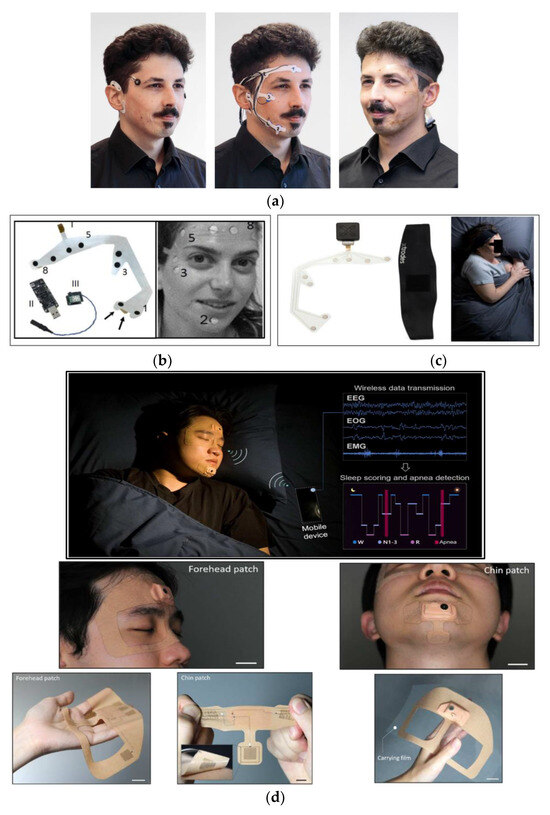 Biosensors | Free Full-Text | Advancements in Wearable EEG Technology for Improved Home-Based ...