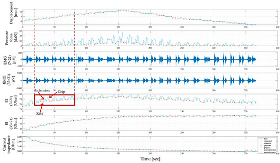 An Approach to Using Electrical Impedance Myography Signal Sensors to ...