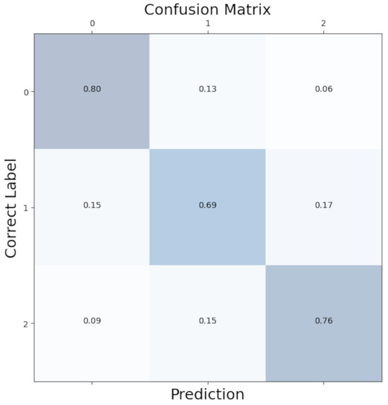 Biosensors | Free Full-Text | Real-Time Classification of Anxiety in ...