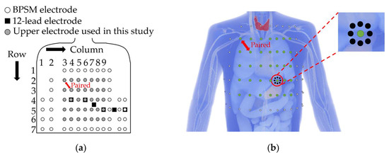 Sensitivity of Electrocardiogram on Electrode-Pair Locations for ...