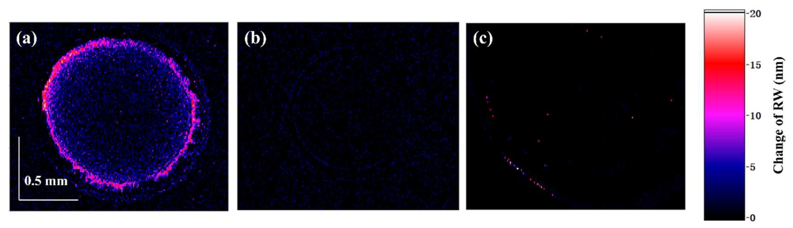 Coffee Ring Effect Enhanced Surface Plasmon Resonance Imaging Biosensor ...