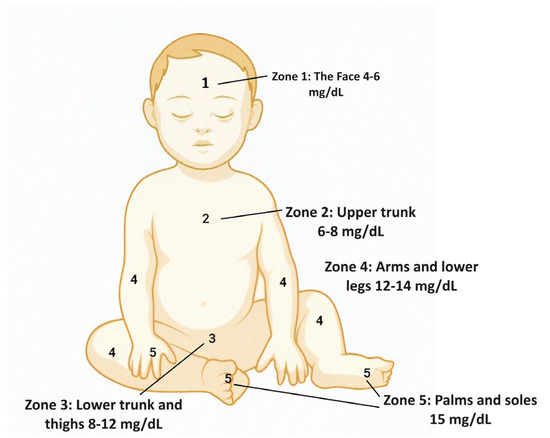 Development of Non-Invasive Biosensors for Neonatal Jaundice Detection ...