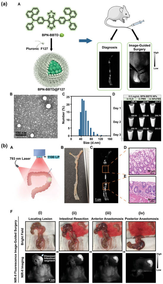 NIR-II Fluorescent Probes for Fluorescence-Imaging-Guided Tumor Surgery