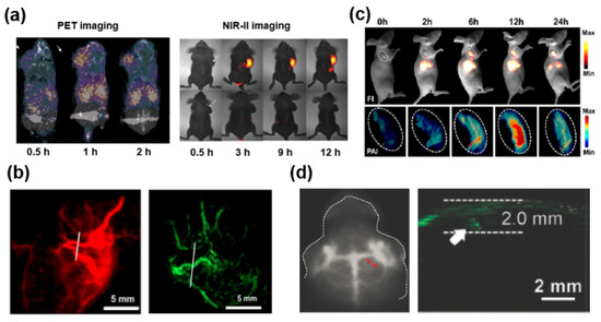 NIR-II Fluorescent Probes for Fluorescence-Imaging-Guided Tumor Surgery