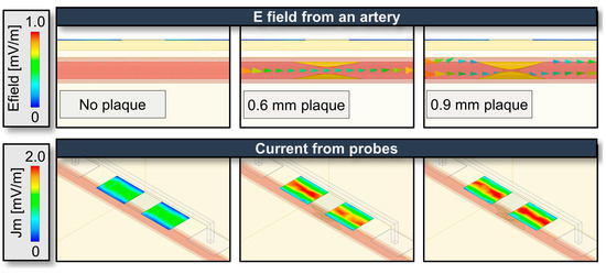 Development of a Tetherless Bioimpedance Device That Uses Morphologic ...