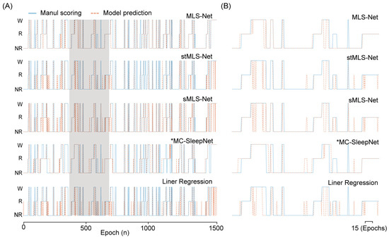 Biosensors | Free Full-Text | MLS-Net: An Automatic Sleep Stage Classifier Utilizing Multimodal ...