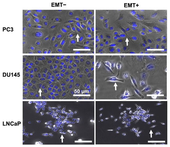 Electrical Impedance Spectroscopy as a Tool to Detect the Epithelial to ...