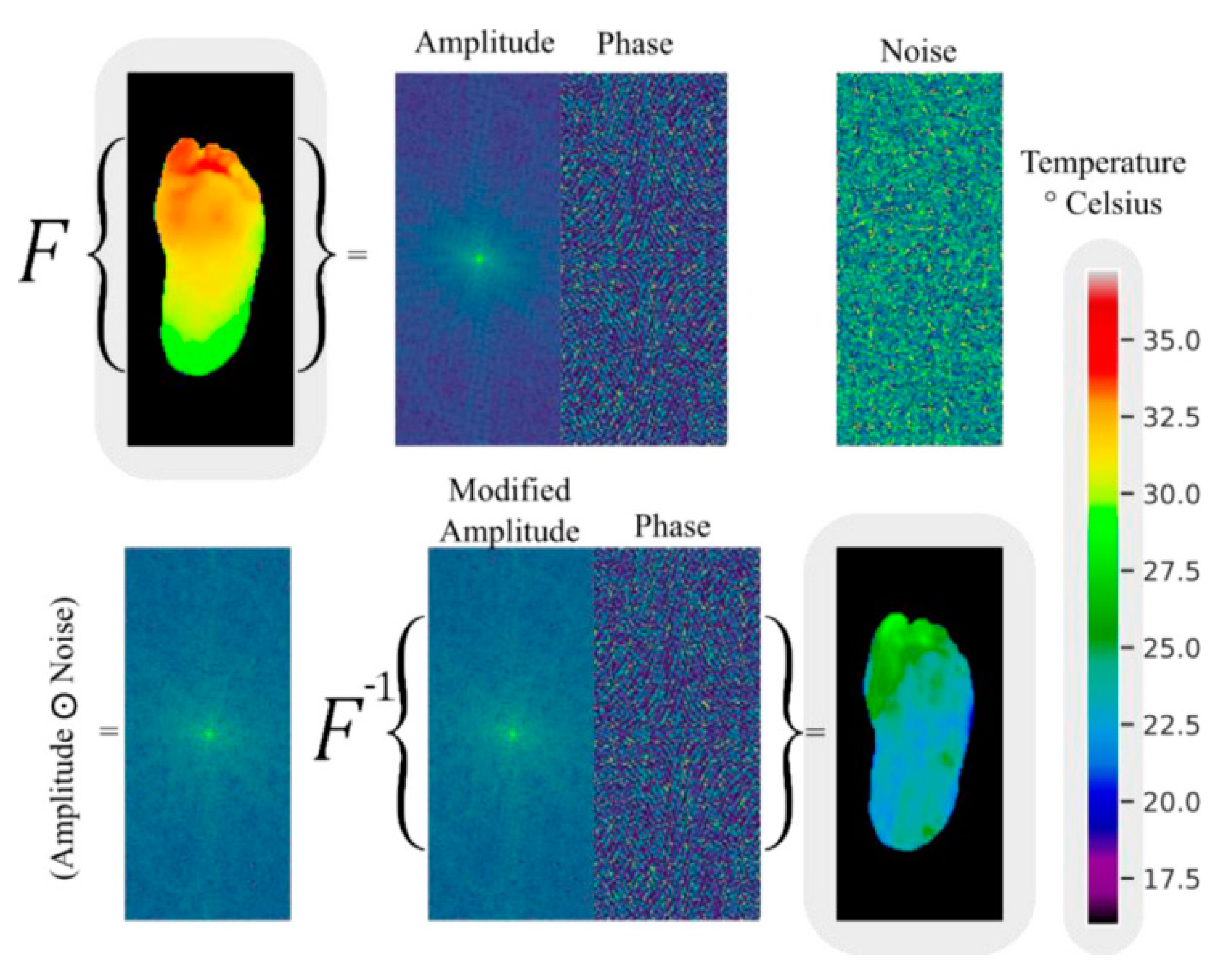 Advances in Machine Learning-Aided Thermal Imaging for Early Detection of Diabetic Foot Ulcers ...