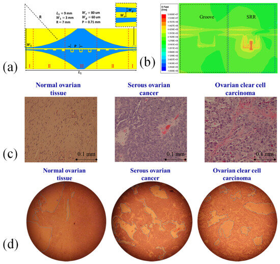 Surface Plasmon Resonance-Based Biodetection Systems: Principles ...