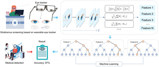 High-Accuracy Intermittent Strabismus Screening via Wearable Eye ...
