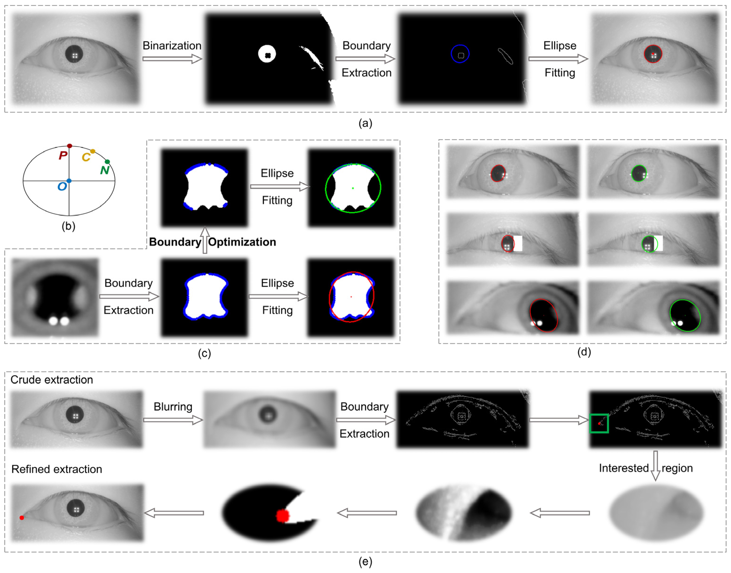 High-Accuracy Intermittent Strabismus Screening via Wearable Eye ...