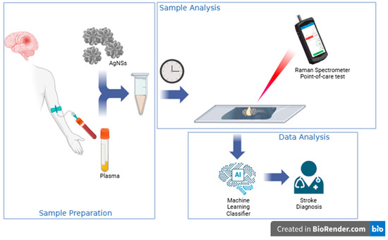 Towards Rapid and Low-Cost Stroke Detection Using SERS and Machine Learning