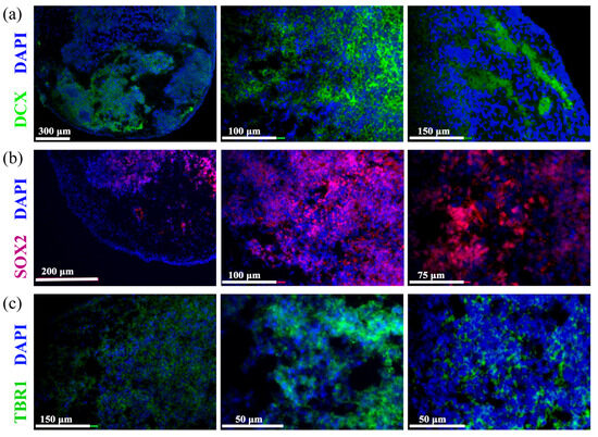 Non-Invasive and Long-Term Electrophysiological Monitoring Sensors for Cerebral Organoids ...