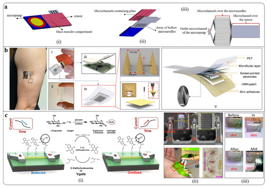 Wearable Electrochemical Glucose Sensors for Fluid Monitoring: Advances ...