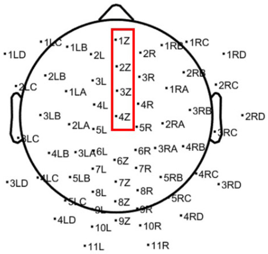 Automatic Calculation of Average Power in Electroencephalography ...