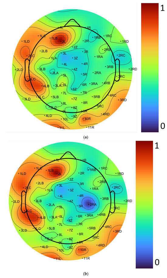Automatic Calculation of Average Power in Electroencephalography ...