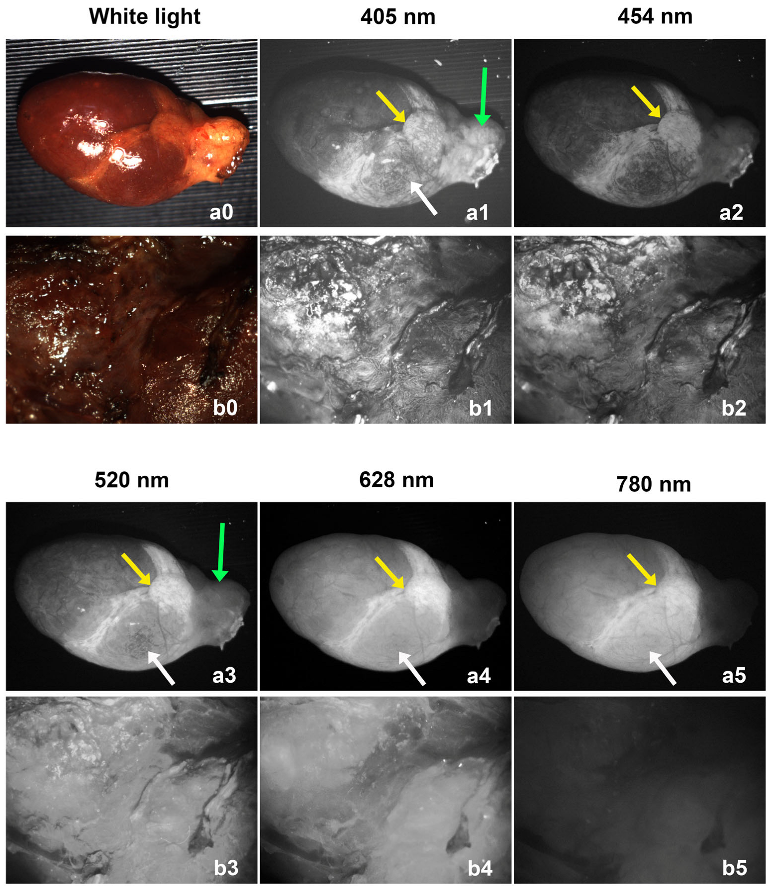 Autofluorescence Imaging of Parathyroid and Thyroid Under Visible and ...