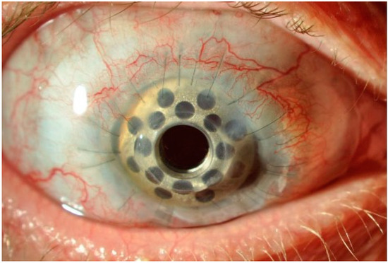 BioTech | Free Full-Text | Ocular-Surface Regeneration Therapies for ...