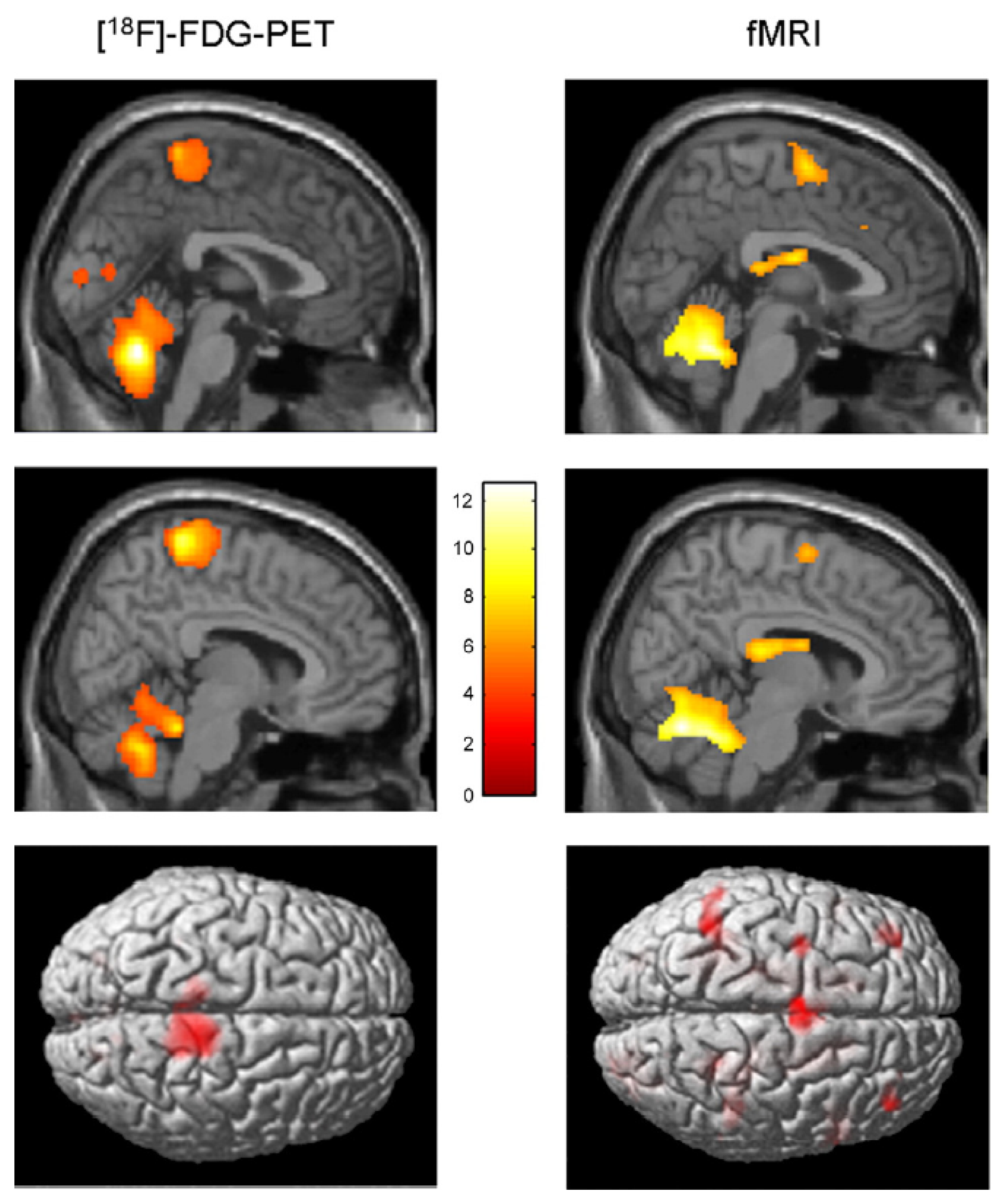 Brain Sciences | Free Full-Text | Towards Effective Non-Invasive Brain ...