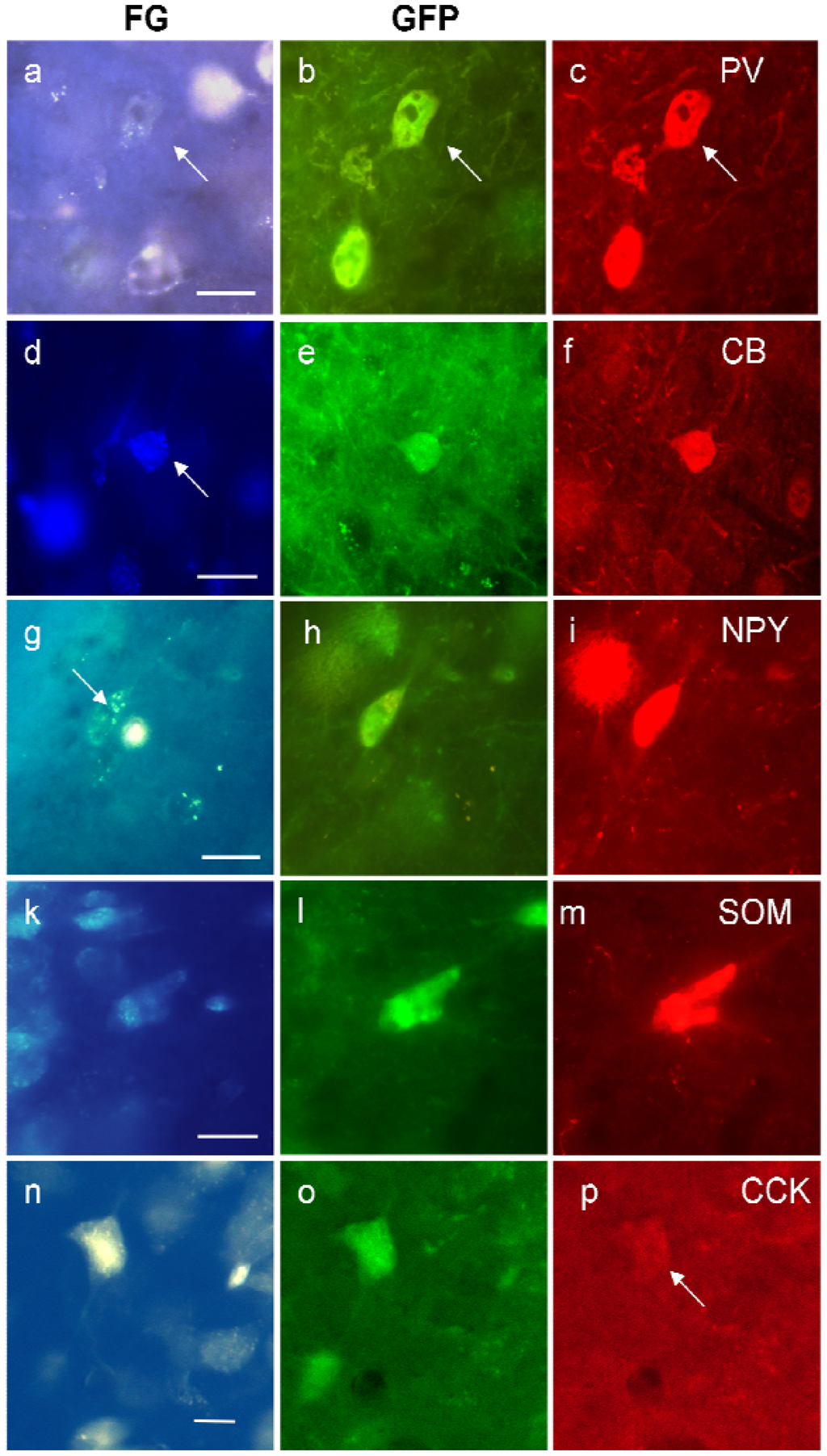 Identification and Characterization of GABAergic Projection Neurons ...