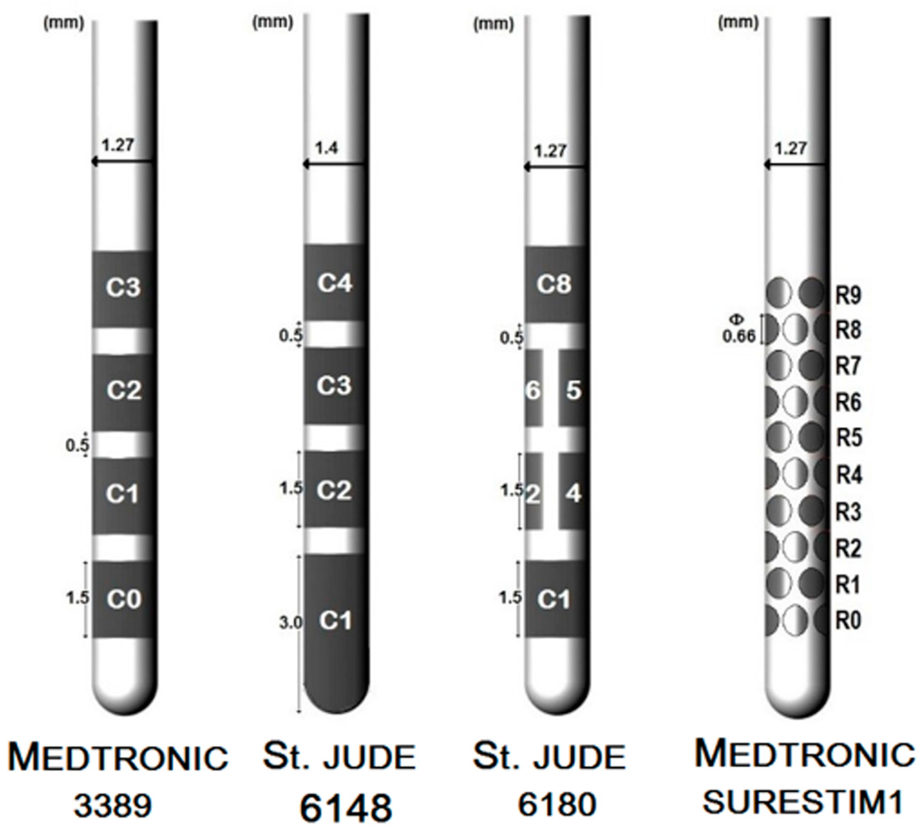 Investigation into Deep Brain Stimulation Lead Designs: A Patient ...